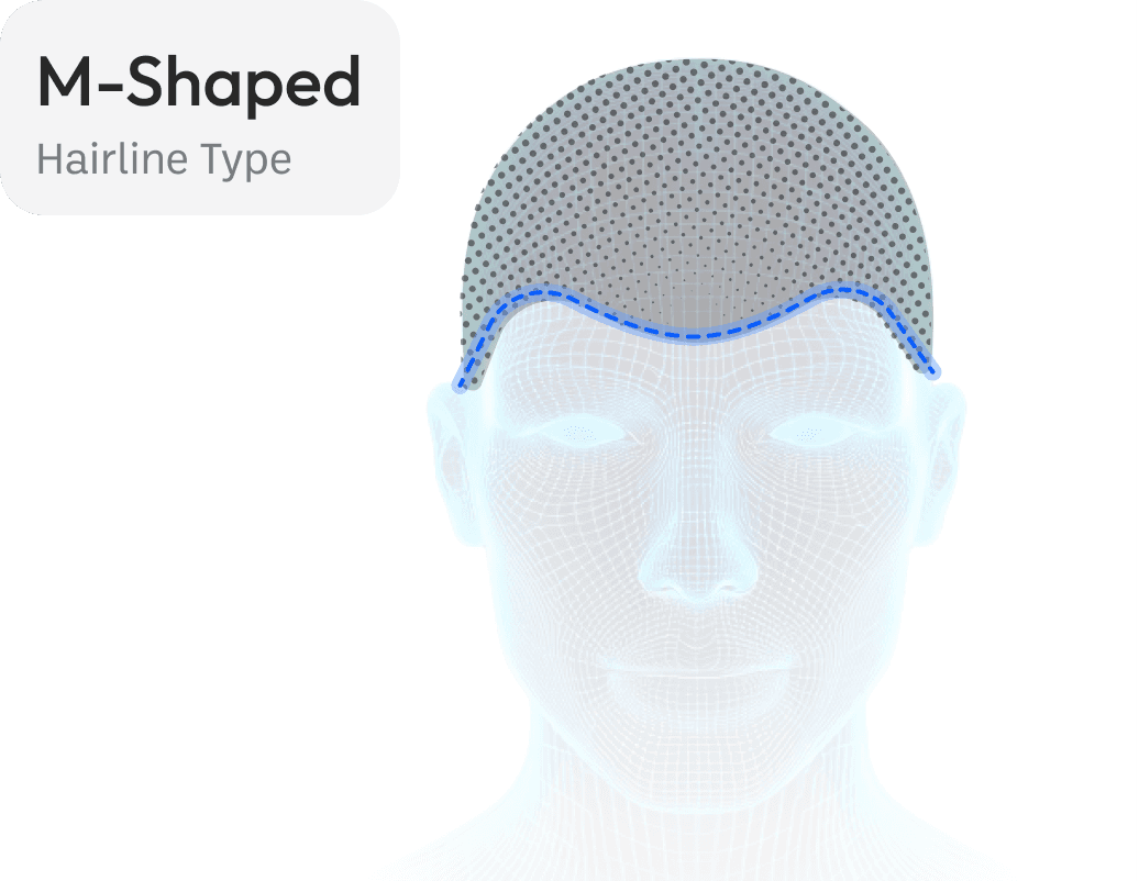 Hair Type Quiz & AI Hair Analysis | MyHair