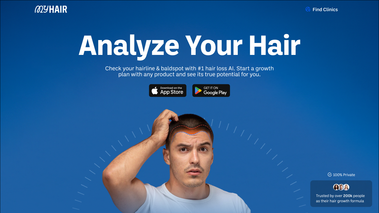 9 Hairline Types and How to Recognize Them | MyHair